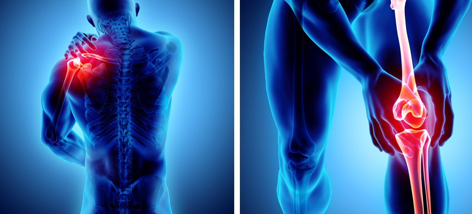 Ostenil Injection Therapy in Colchester | Mersea Road Clinic